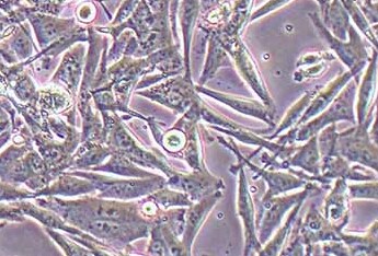 皮肤恶性黑色素瘤细胞系SK-MEL-5(STR鉴定正确) Skin malignant melanoma cell SK-MEL-5SK ...